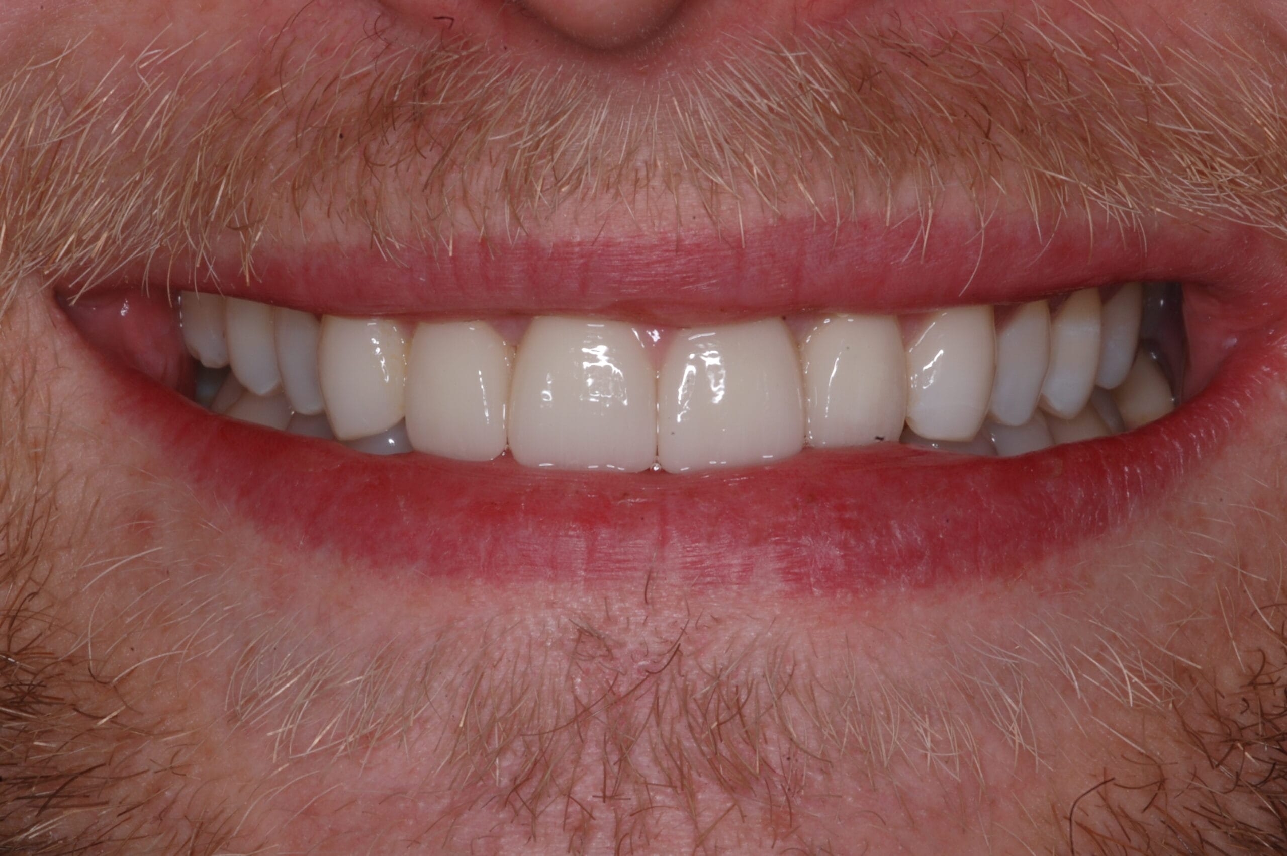 Treatment Gallery - Dentist Chester